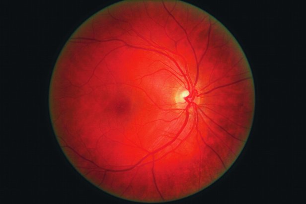 Top 5 Facts: Vision – How It Works