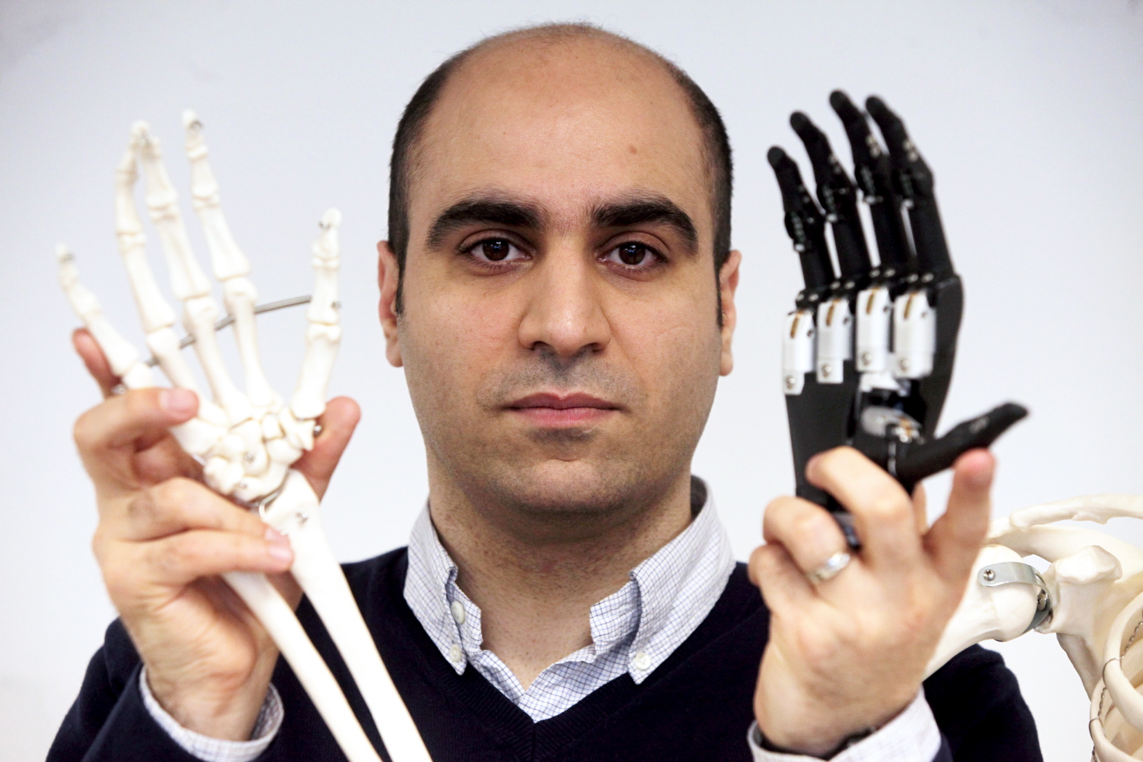 Bionic Hands