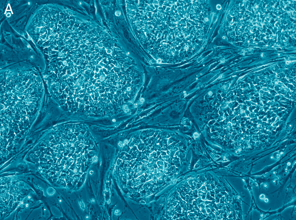 Stem cell bank offers storage for therapeutic cloning – How It Works
