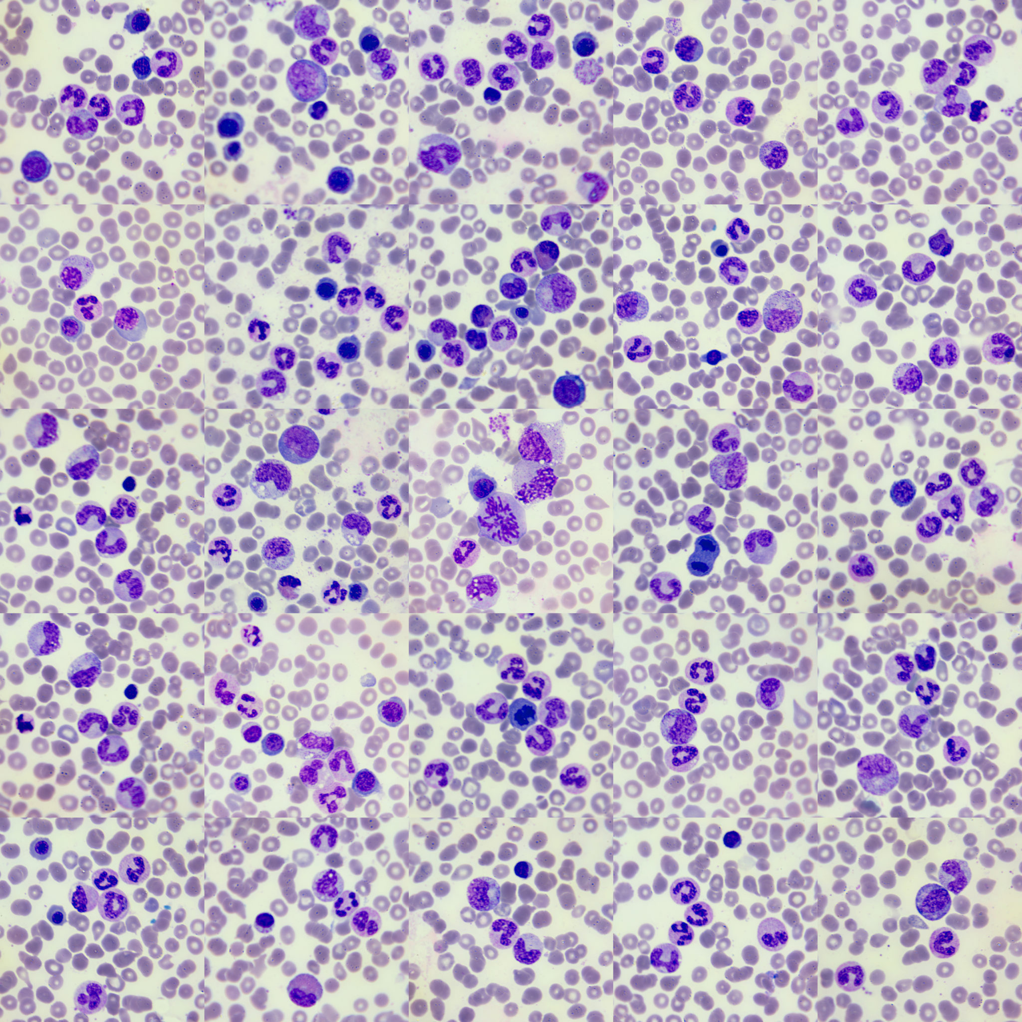 What is bone marrow? – How It Works